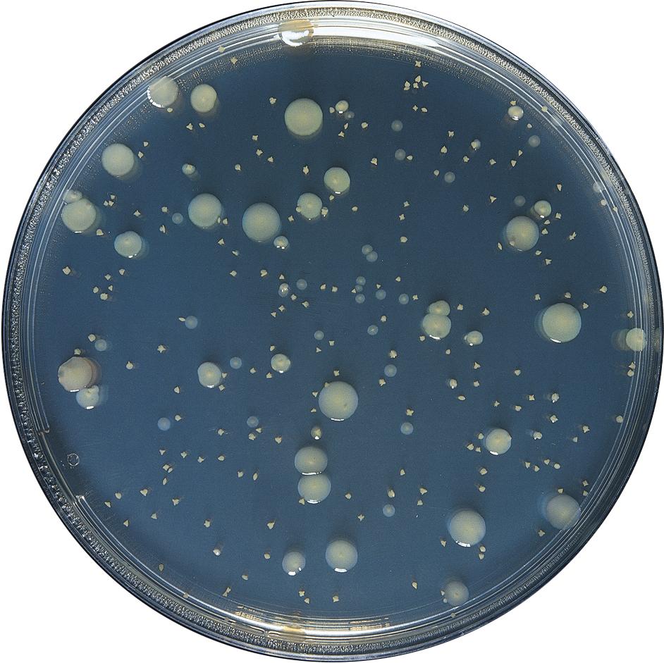 Yeast Extract Agar | PVL Produtos para Laboratório, Lda